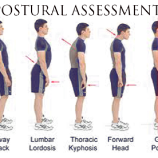 Postural Assessment ( Visual Observation )