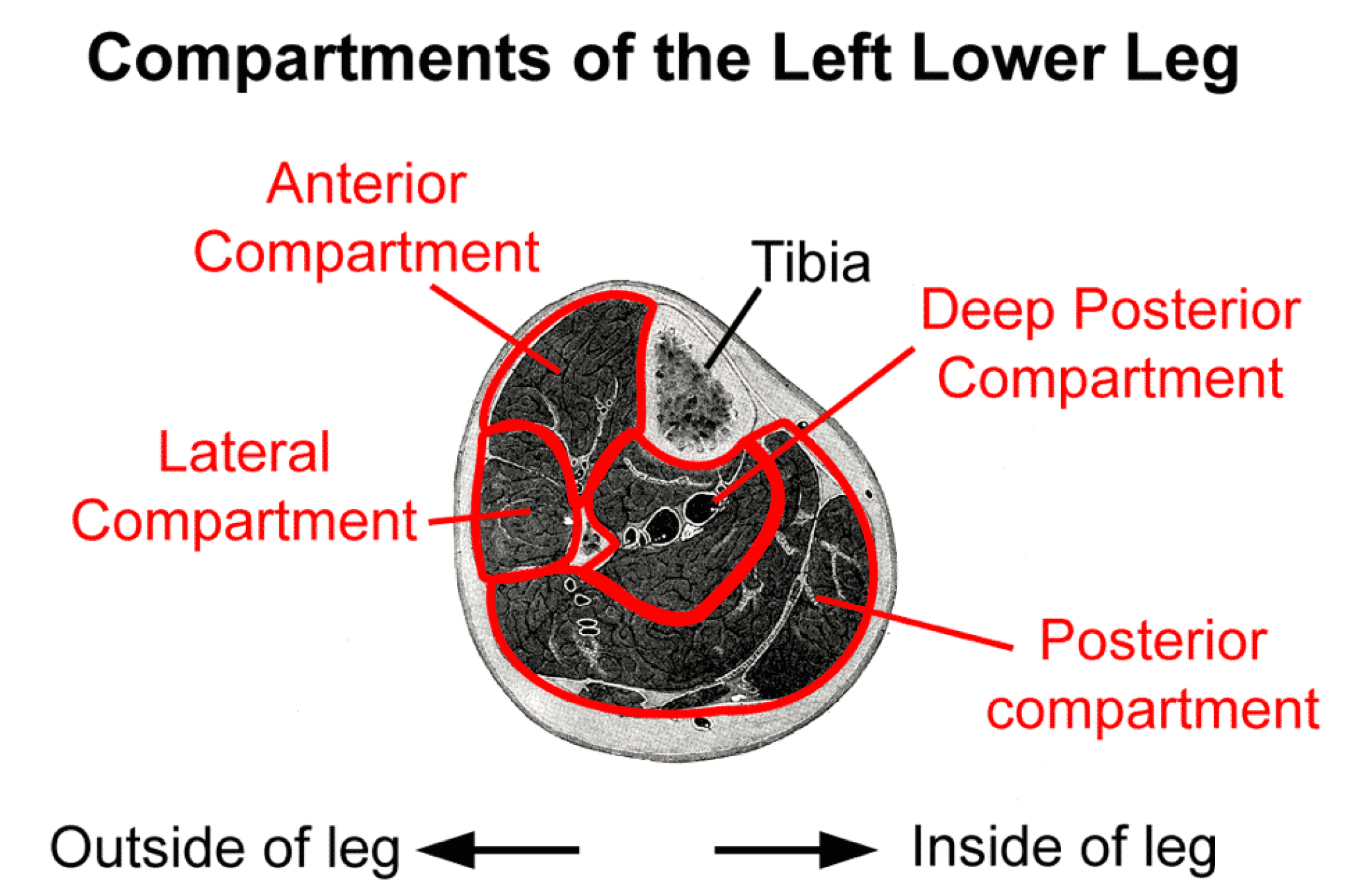 Compartment Syndrome Massage Treatment