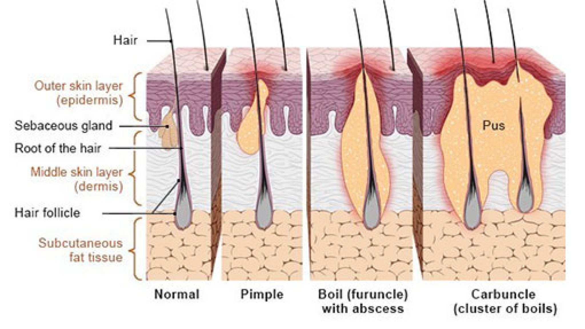 Avoid Massage with these 19 Skin Conditions! (with Pictures)