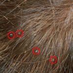 Avoid Massage with these 19 Skin Conditions! (with Pictures)