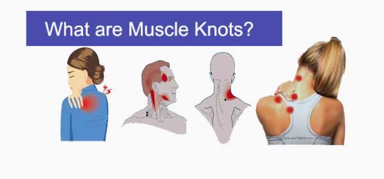 What are Muscle KNOTS? | Medical Massage Therapy