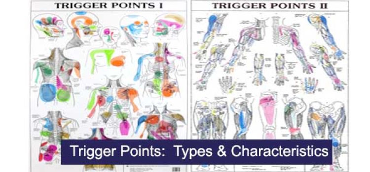 4 TYPES and 8 Characteristics of TRIGGER POINTS